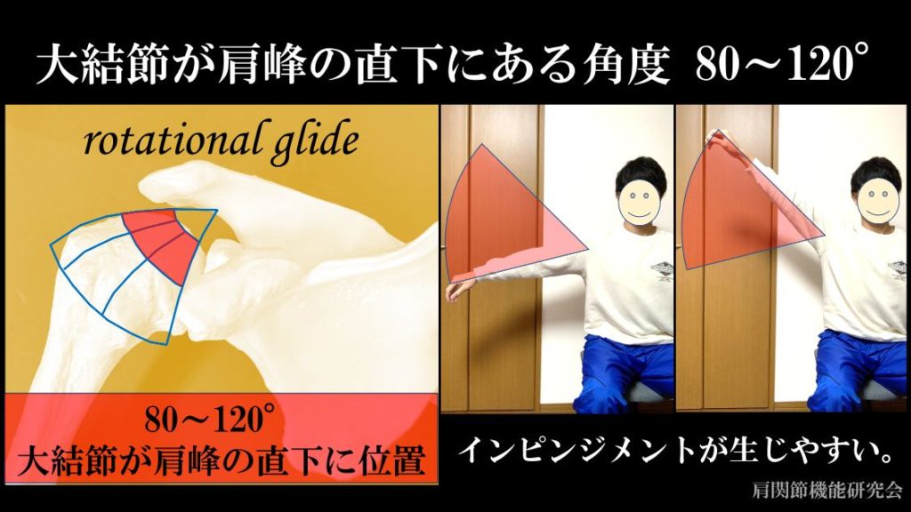 みんな知ってる？肩すくめ徴候Shoulder shrug sign | 肩関節機能研究会(肩研)