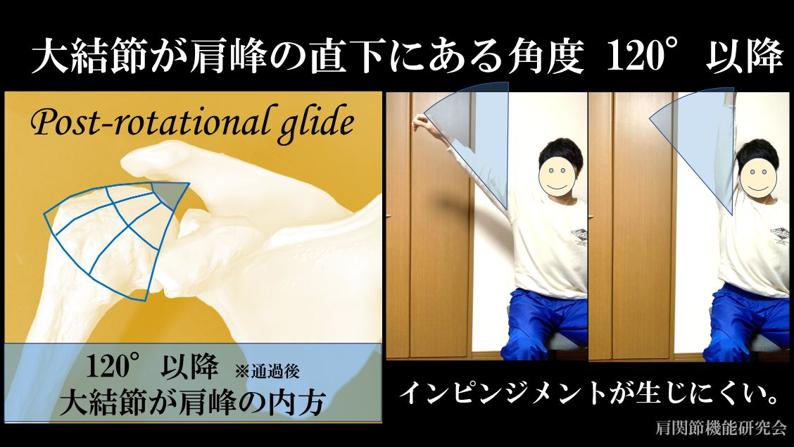Shoulder shrug signの病態と臨床応用 | 肩関節機能研究会(肩研)