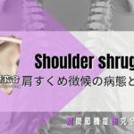Shoulder shrug signの病態と臨床応用